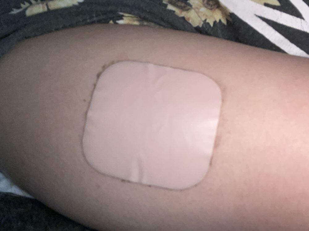 [Evra] Czy plaster Evra jest przyklejony prawidłowo? | Gdzie po lek