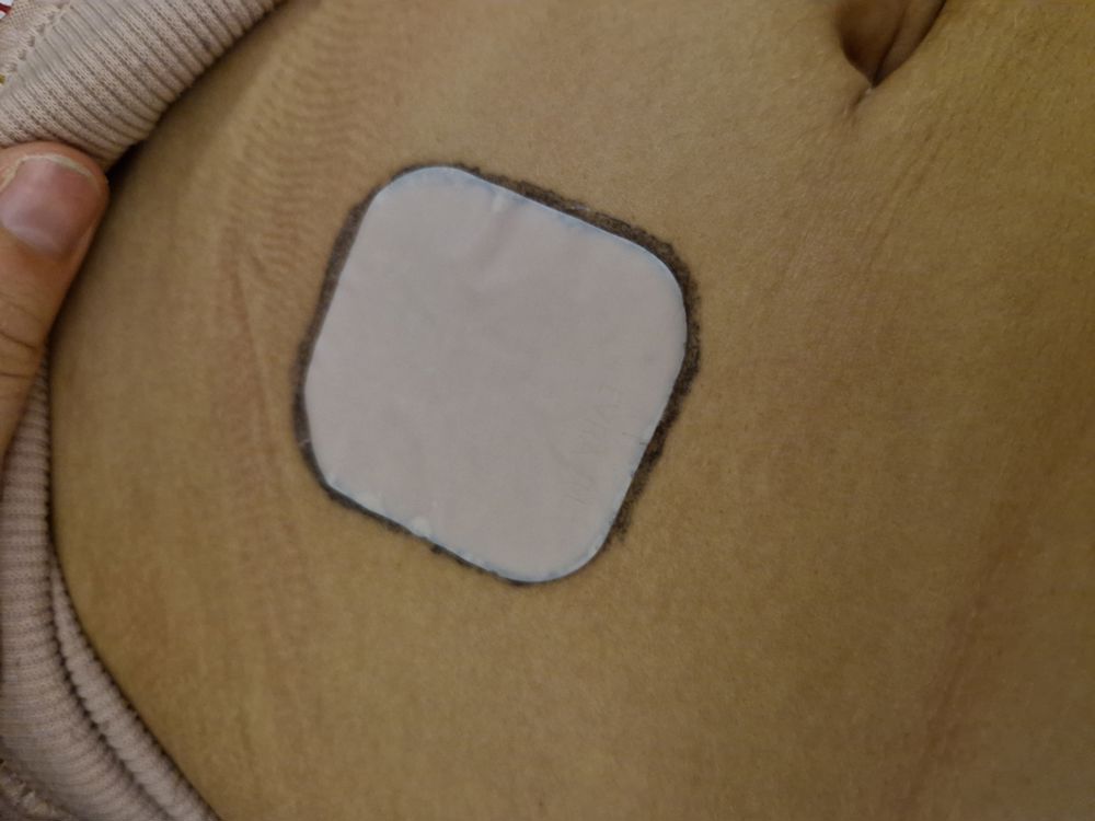 [Evra] Czy tak wyglądający plaster Evra dalej pełni swoją funkcję ...